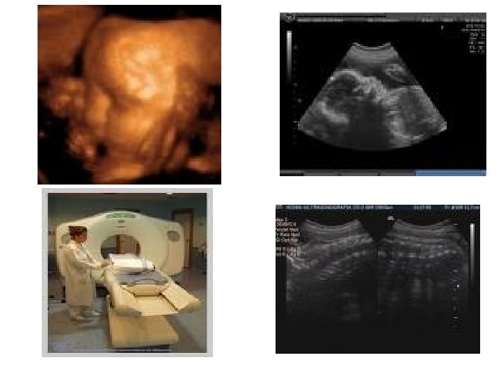 ETAPA EMBRIONARIA Desarrollo de la placenta y los