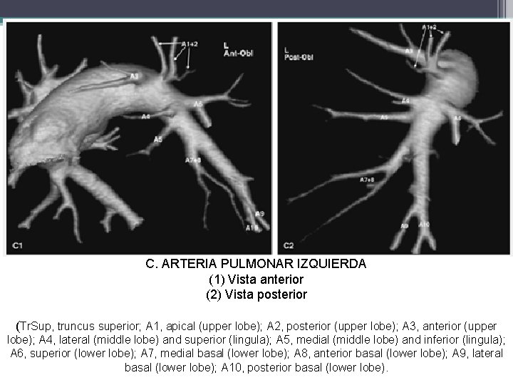 Anatoma Hiliar Pulmonar Dra Marcela Veloz E ION