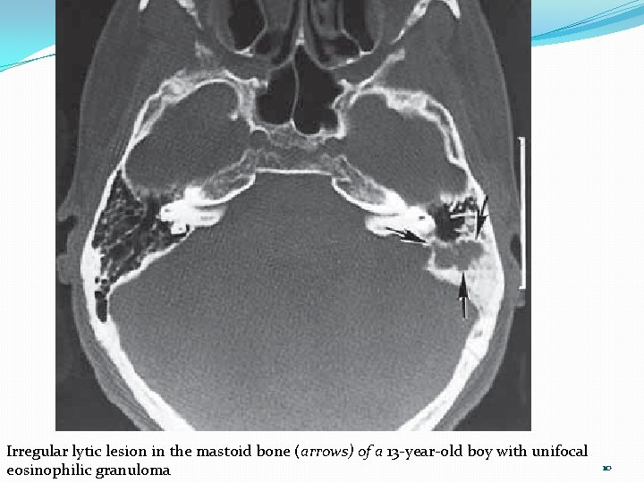 granulomatous and infectious diseases neoplasms disorders of bone