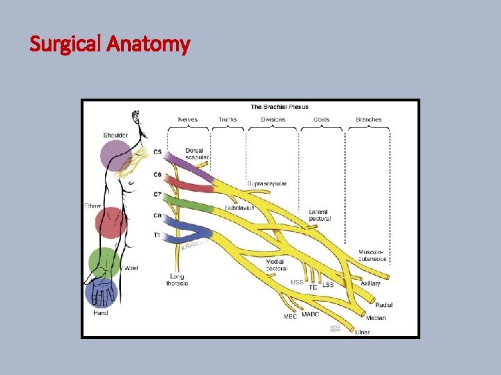 Brachial plexus injury is classified According to the