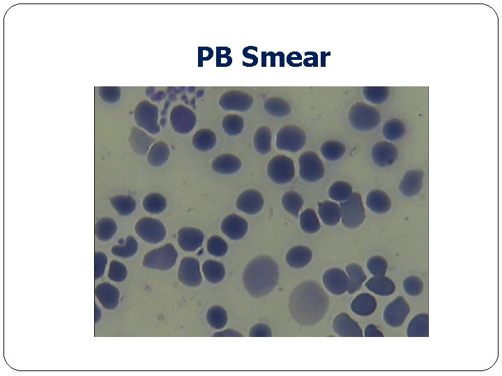 In the name of God Case presentation Immune