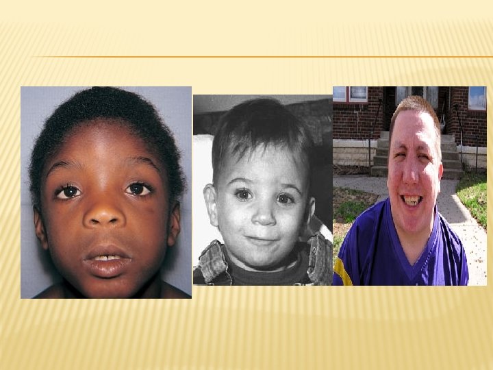 FETAL ALCOHOL SPECTRUM DISORDERS THE INVISIBLE DISABILITY FASD