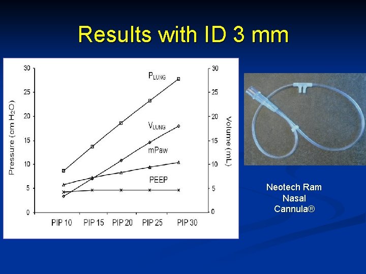 Nasal Cannula Intermittent Mandatory Ventilation NCIMV Introduction n