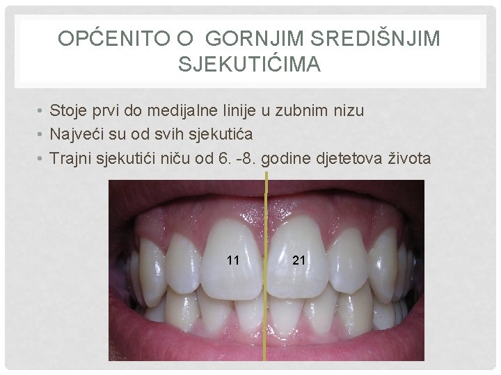 GORNJI SREDINJI SJEKUTI DENS INCISIVUS MEDIALIS SUPERIOR 11