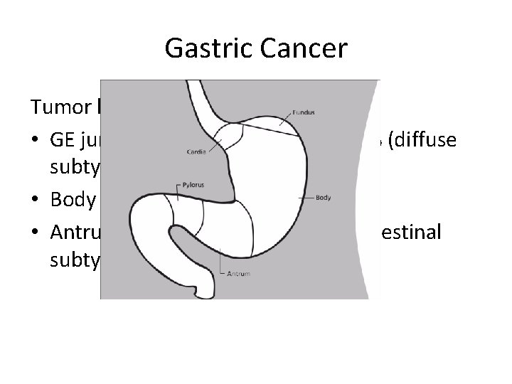 Digestive system cancers Ph D Tomasz Winiewski Esophageal