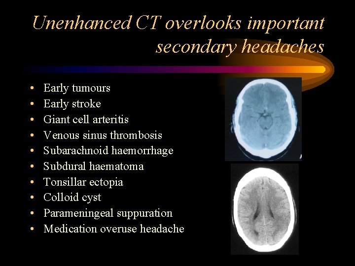 Imaging in headache patients Incidentalomas Giles Elrington Barts