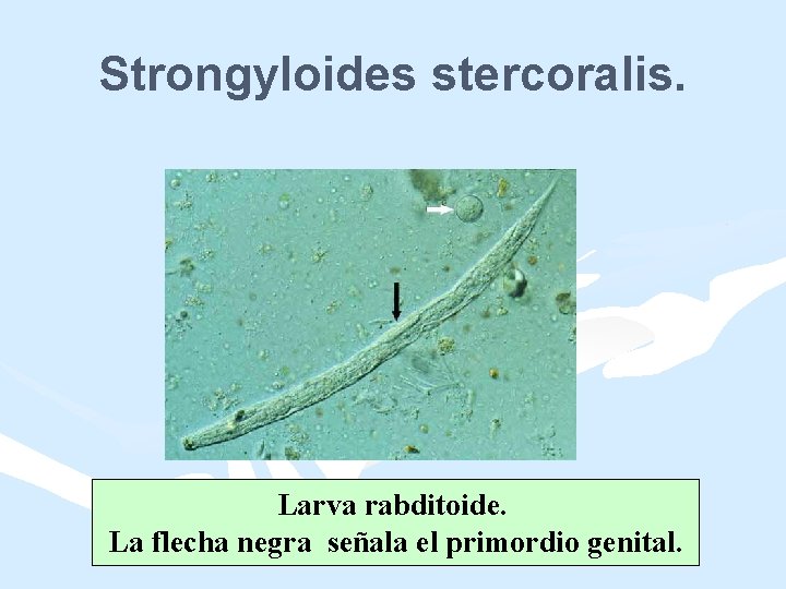 Parasitismo Intestinal Definicin Las Helmintiasis Transmitidas por contacto