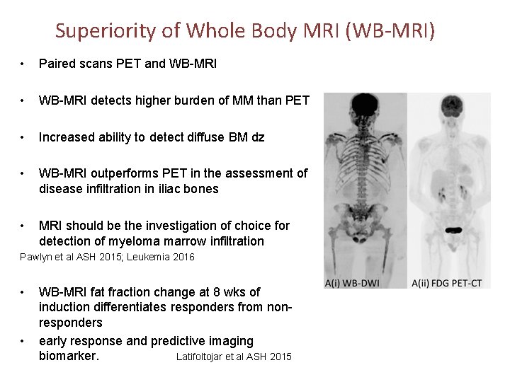 Whole Body Magnetic Resonance Imaging in Newly Diagnosed