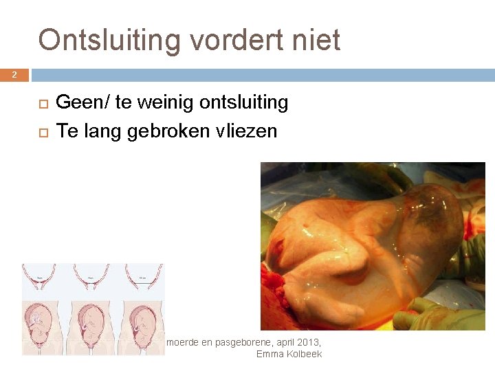AANDOENINGEN TIJDENS EN VLAK NA DE BEVALLING Bij
