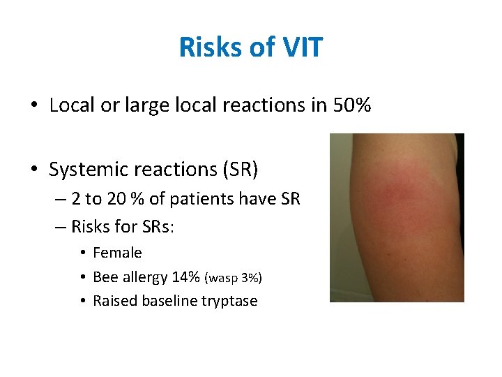 Bee Venom Immunotherapy Dr Aarn Huissoon Consultant Immunologist