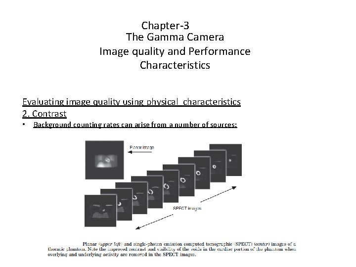 Chapter3 The Gamma Camera Image quality and Performance