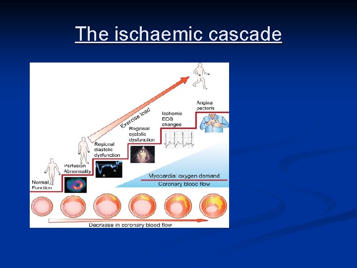 Investigations and Treatment for Stable Coronary Artery Disease