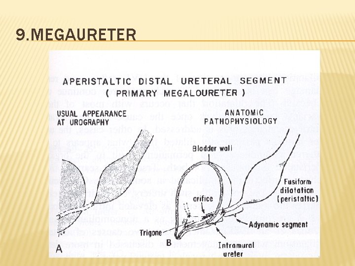 PAEDIATRIC UROLOGY CONGENITAL ABNORMALITIES not uncommon 1200 have