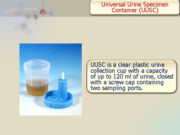 NOVAmed Ltd Presents UTISET SYSTEM Urinary tract infections