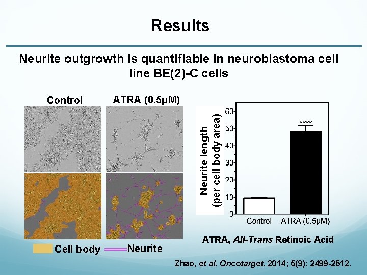 Cell differentiation and differentiation therapy in neuroblastoma Liqin
