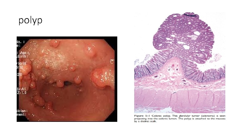 Classification of Tumors Slides were taken from Dr