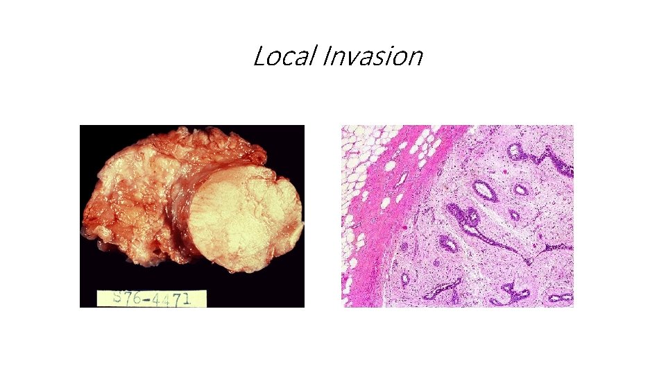 Classification of Tumors Slides were taken from Dr