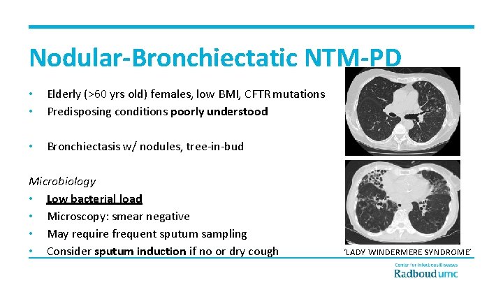 Treatment of nontuberculous mycobacterial pulmonary disease ...