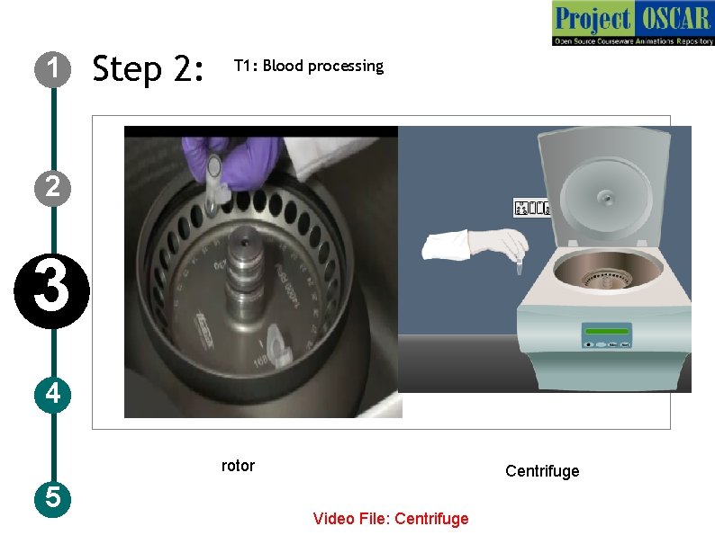 Methodology for the extraction of Plasmodium protein Extraction