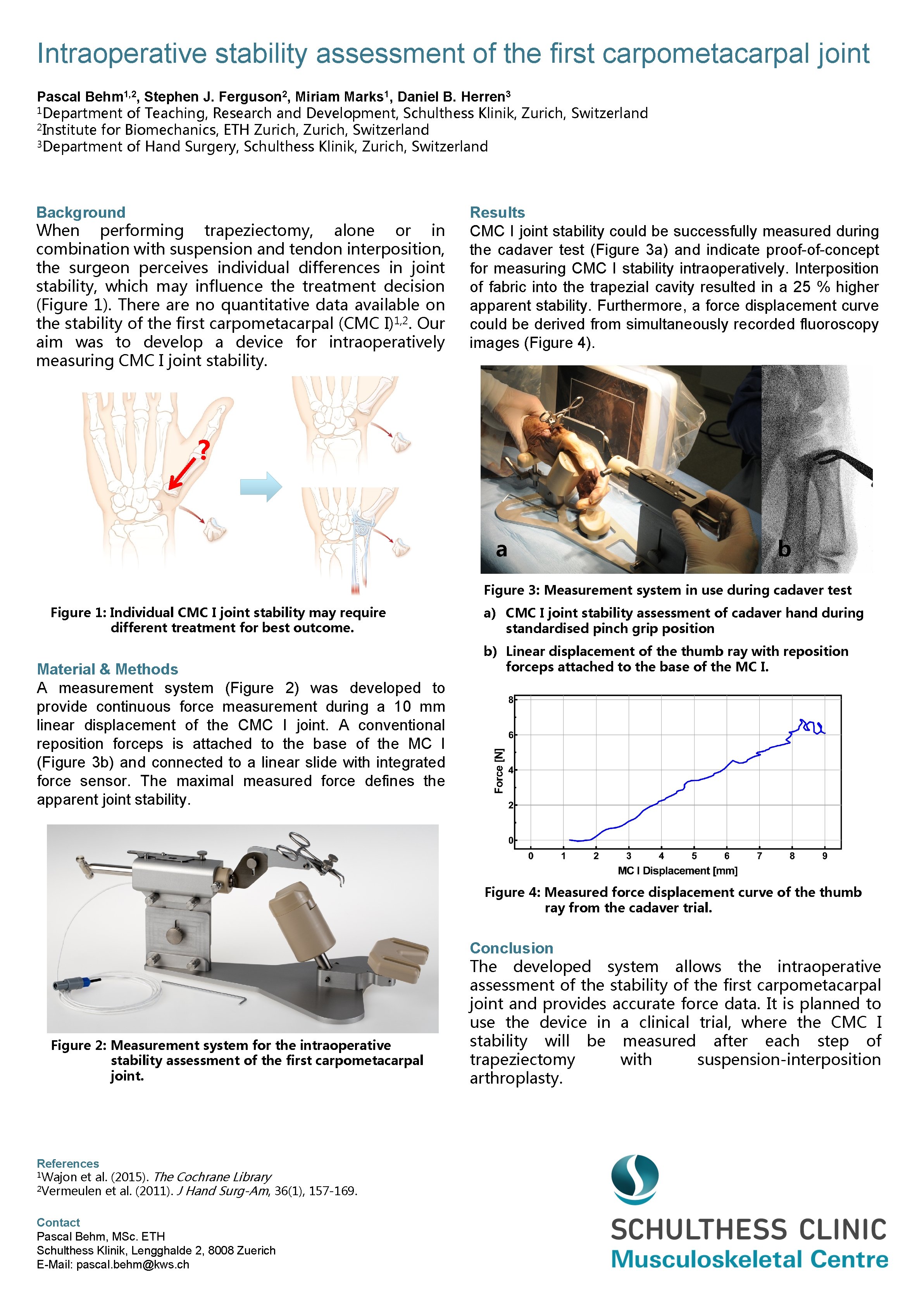 Intraoperative stability assessment of the first carpometacarpal joint