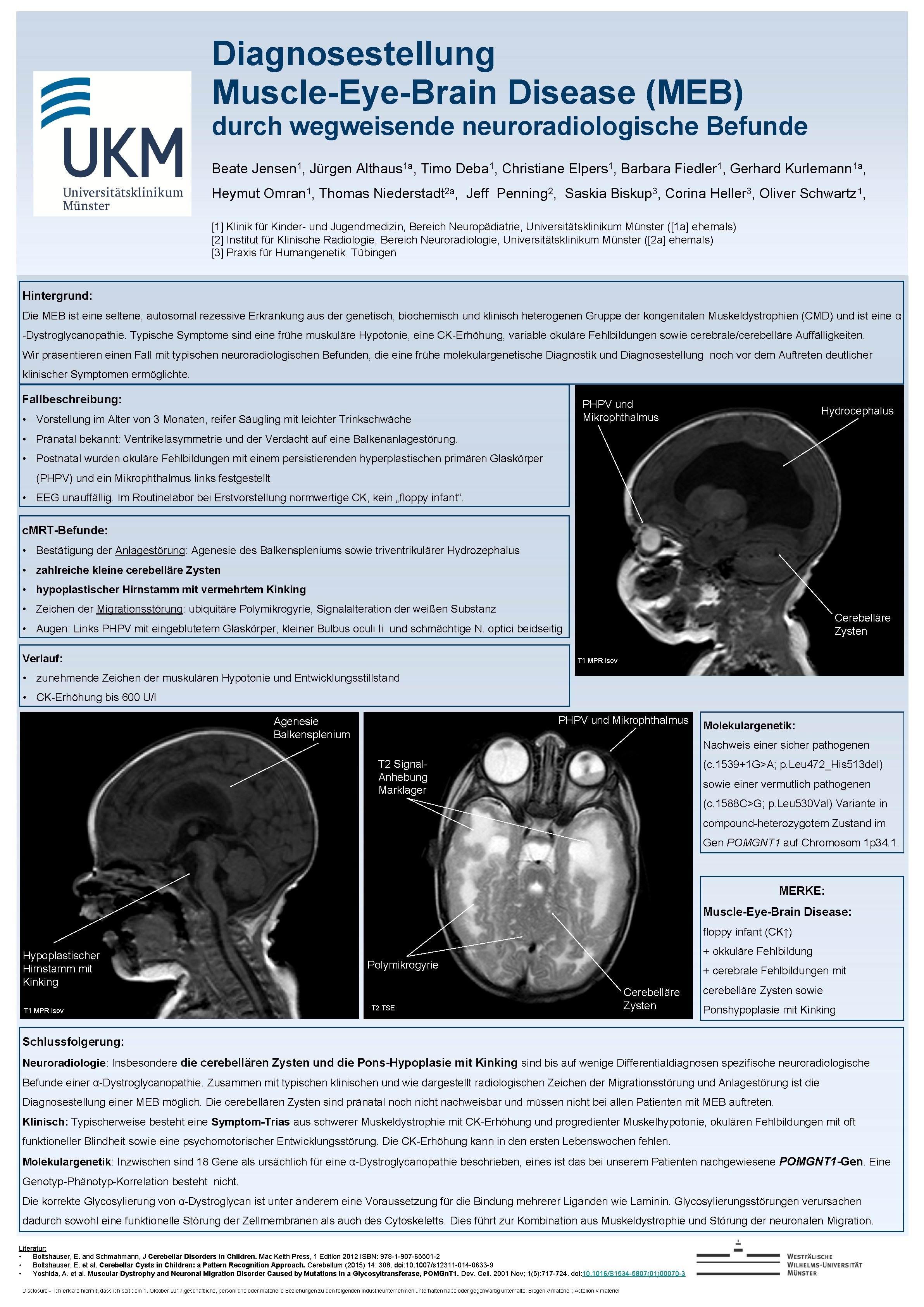 Diagnosestellung MuscleEyeBrain Disease MEB durch wegweisende ...