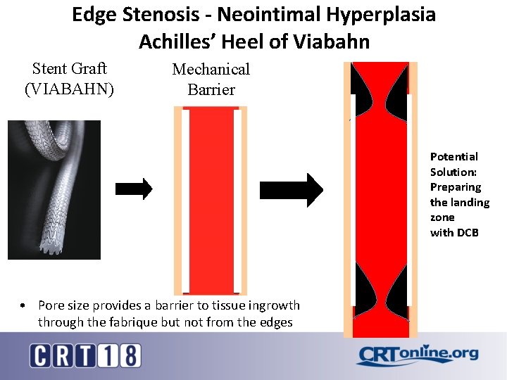 Viabahn Long Stent Grafts for Reanalyzing Long SFA