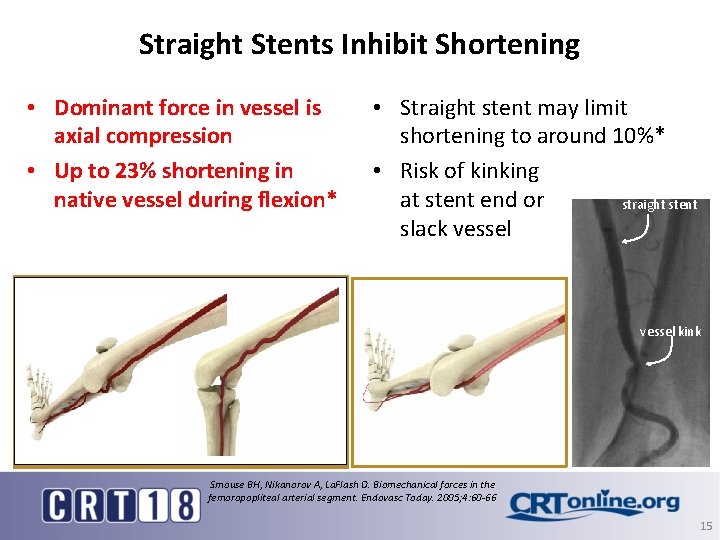 Viabahn Long Stent Grafts for Reanalyzing Long SFA