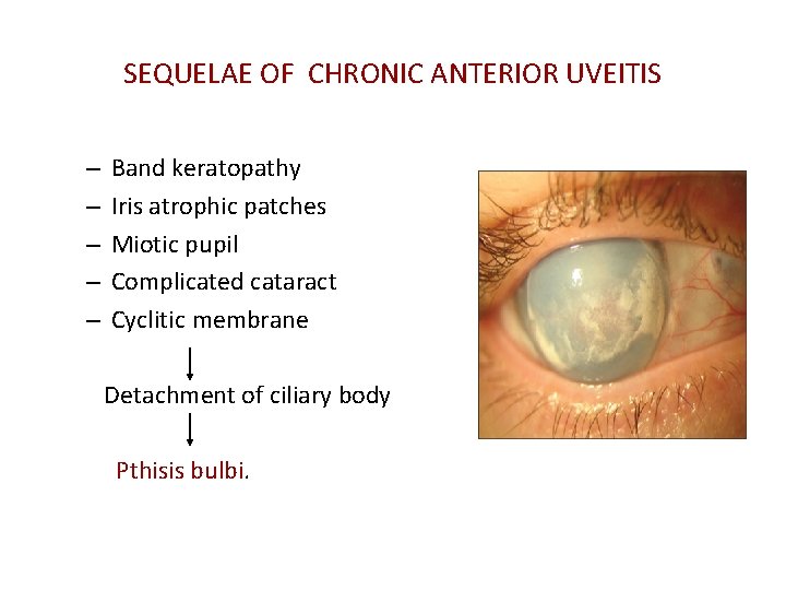 CLINICAL FEATURES OF IRIDOCYCLITIS DR VIVEKANAND U What