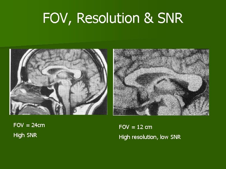 Parameters and Tradeoffs n Signal to noise ratio