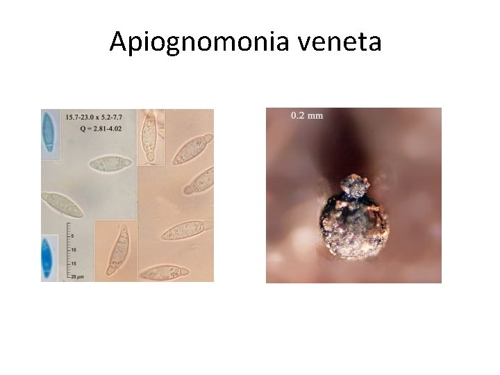 Apiognomonia veneta Apiognomonia veneta Reino Divisin Subfilum Clase