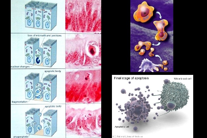 ASPECTOS GERAIS DA MORTE CELULAR MORTE CELULAR ACIDENTAL