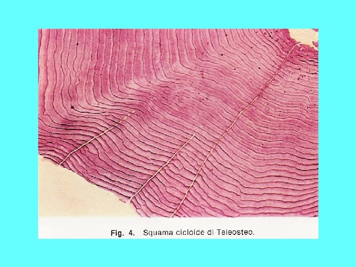 GLI OSTEITTI Osteitti aspetti generali Gli osteitti o