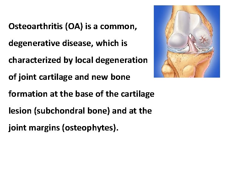 OSTEOARTHRITIS Osteoarthritis OA is a common degenerative disease