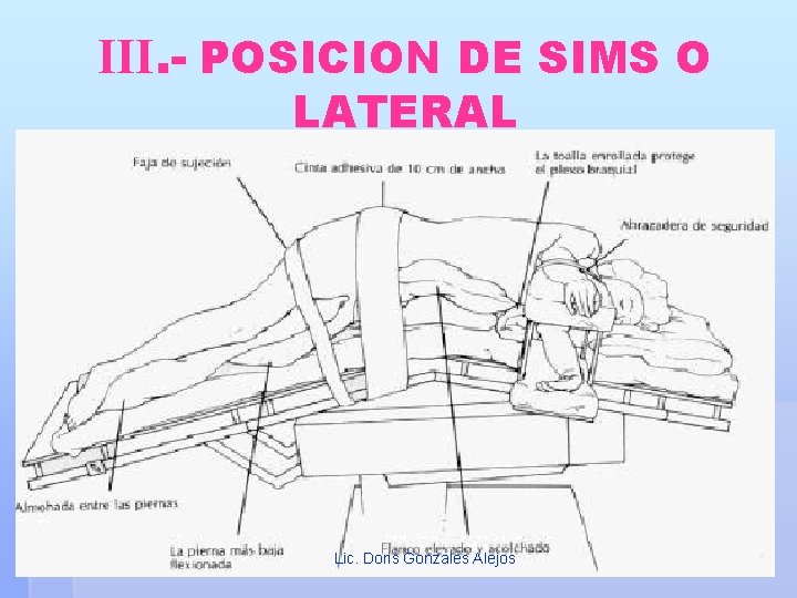 POSICIONES DEL PACIENTE PARA CIRUGA Lic Doris Gonzales