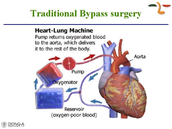 Background l vs l Preoperative autologous blood donation