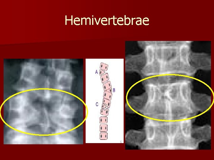 Board Review Gastroenterology ANSWERS Board Review Gastroenterology 1