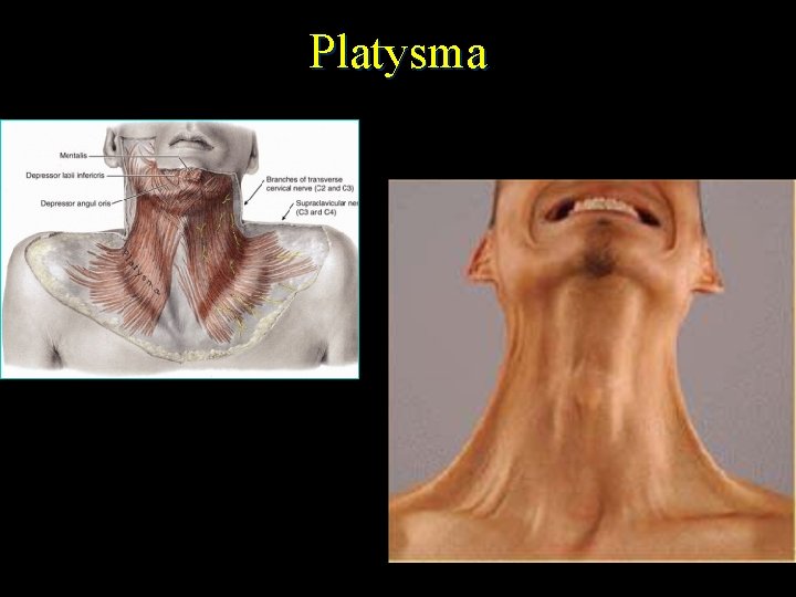 Good morning Deep Cervical Fascia DR QUDSIA SULTANA