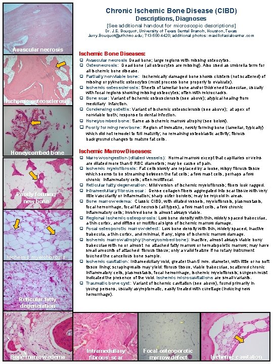 Chronic Ischemic Bone Disease CIBD Descriptions Diagnoses See