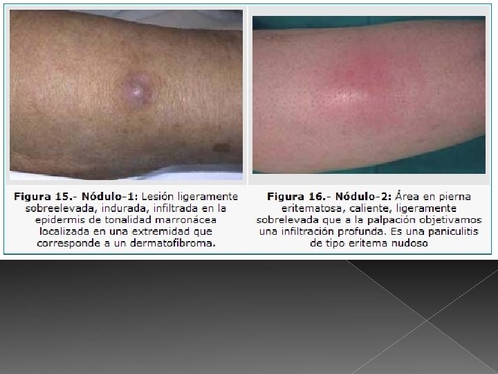 Lesiones primarias FUNCIONES DE LA PIEL Histologa Epidermis