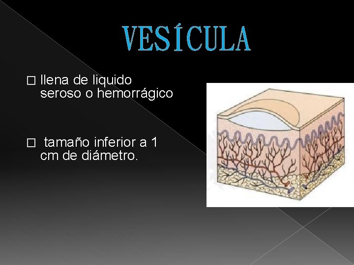 Lesiones primarias FUNCIONES DE LA PIEL Histologa Epidermis