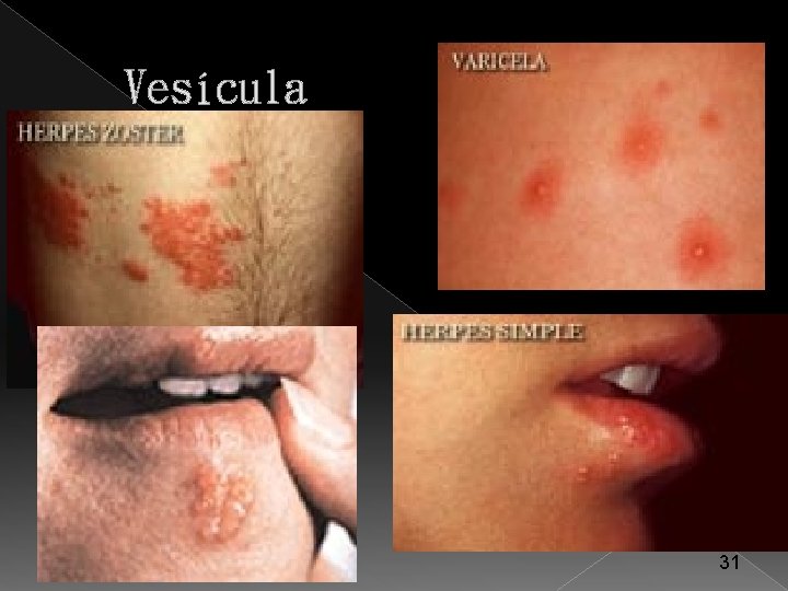 Lesiones primarias FUNCIONES DE LA PIEL Histologa Epidermis