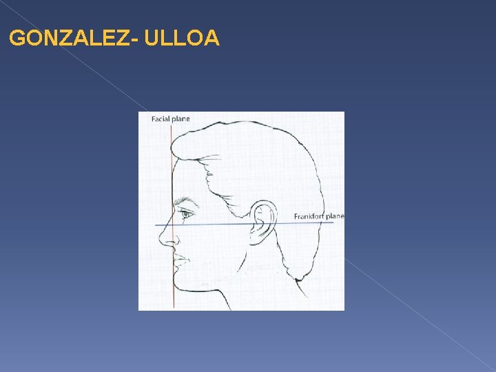 PERFILOMETRIA FACIAL PERFILOMETRIA FACIAL Conceptos ES LA PROPORCION