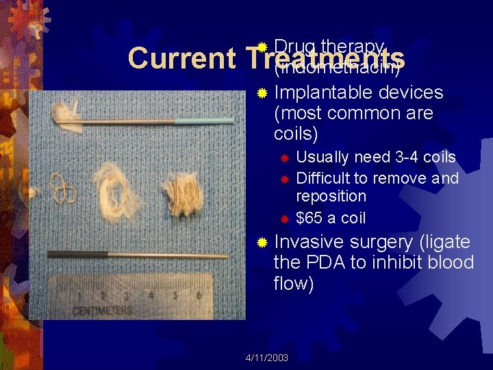 Patent Ductus Arteriosus Occlusion Device Oral Presentation 4
