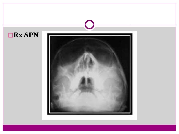 Caso del mes Agosto 2015 HOSPITAL DE NIOS
