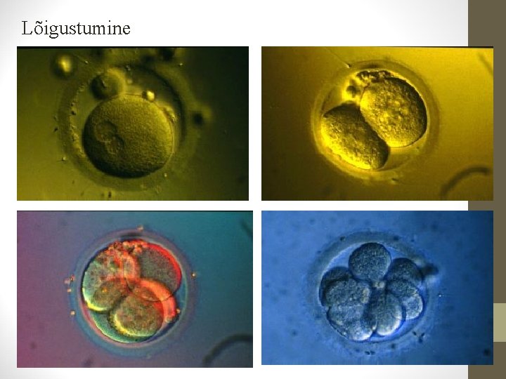 Inimese paljunemine Suguelundkonna ehitus ELUNDKONNAD histe lesannetega ...