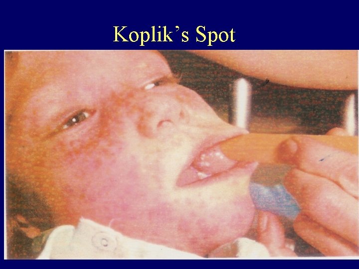 Viral Infections of the Respiratory System Dr MONA