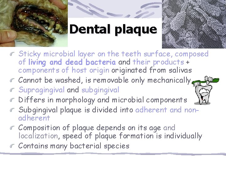 Biofilm dental plaque MUDr ernohorsk Lenka Ph D
