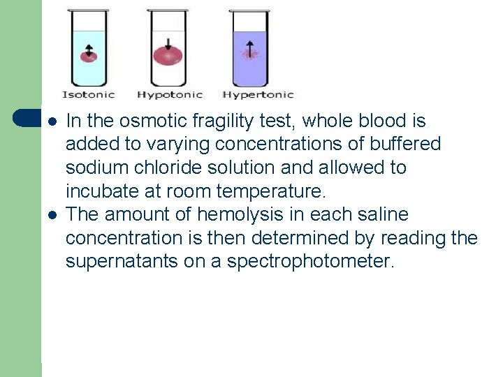 OSMOTIC FRAGILITY TEST Mr Wael Allaithi Definition l