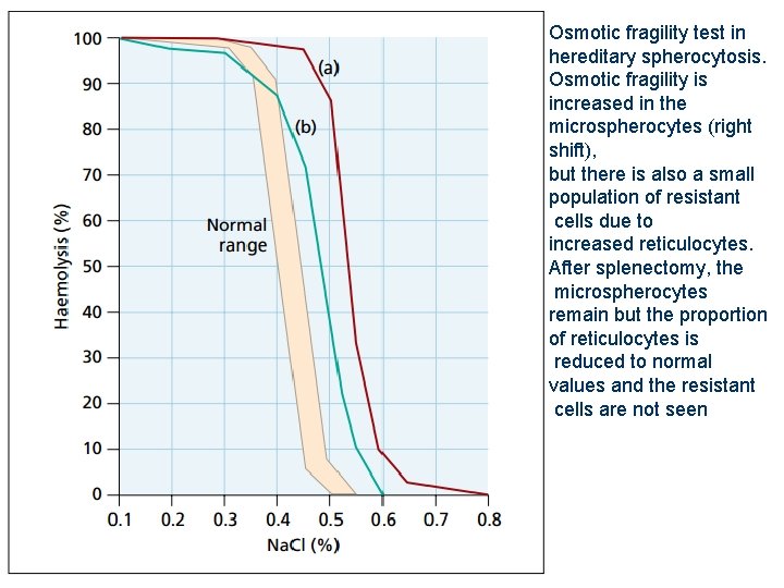 OSMOTIC FRAGILITY TEST Mr Wael Allaithi Definition l