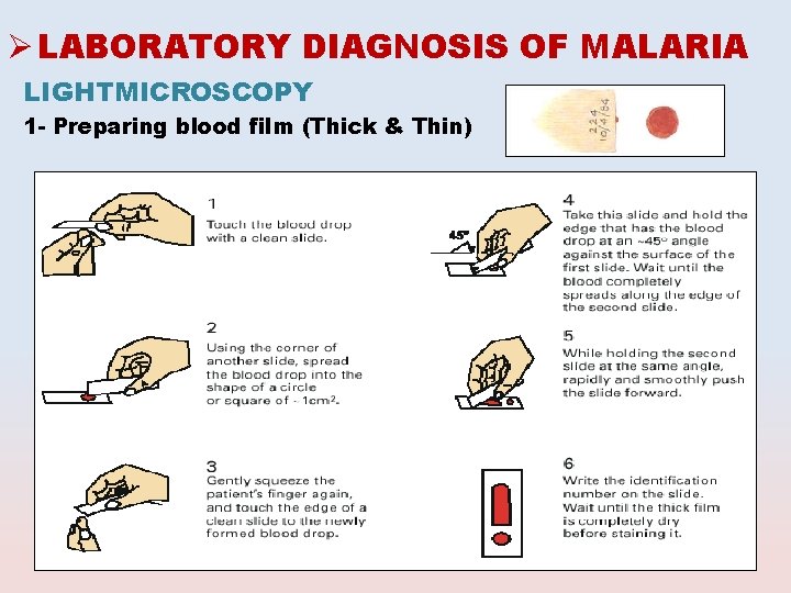 BLOOD AND TISSUE PARASITES Microbiology Practical Class MALARIA